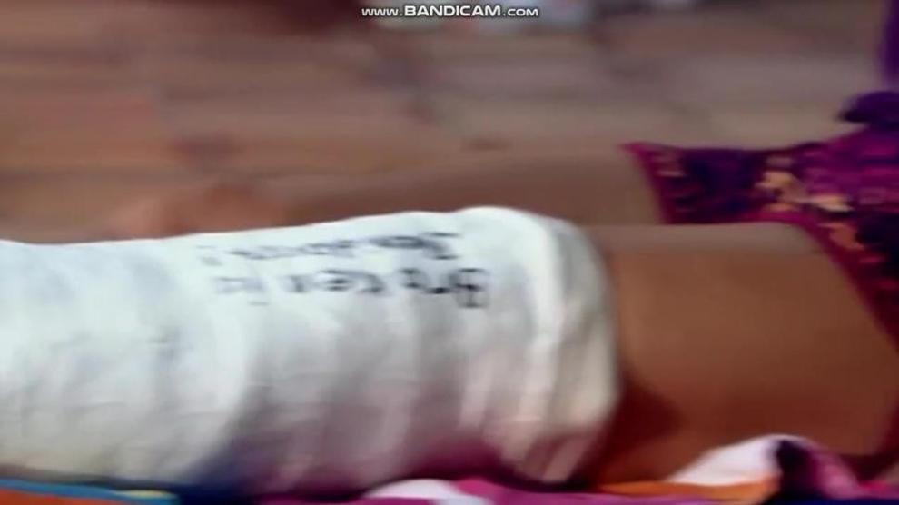 Cast Leg Llc Porn Videos